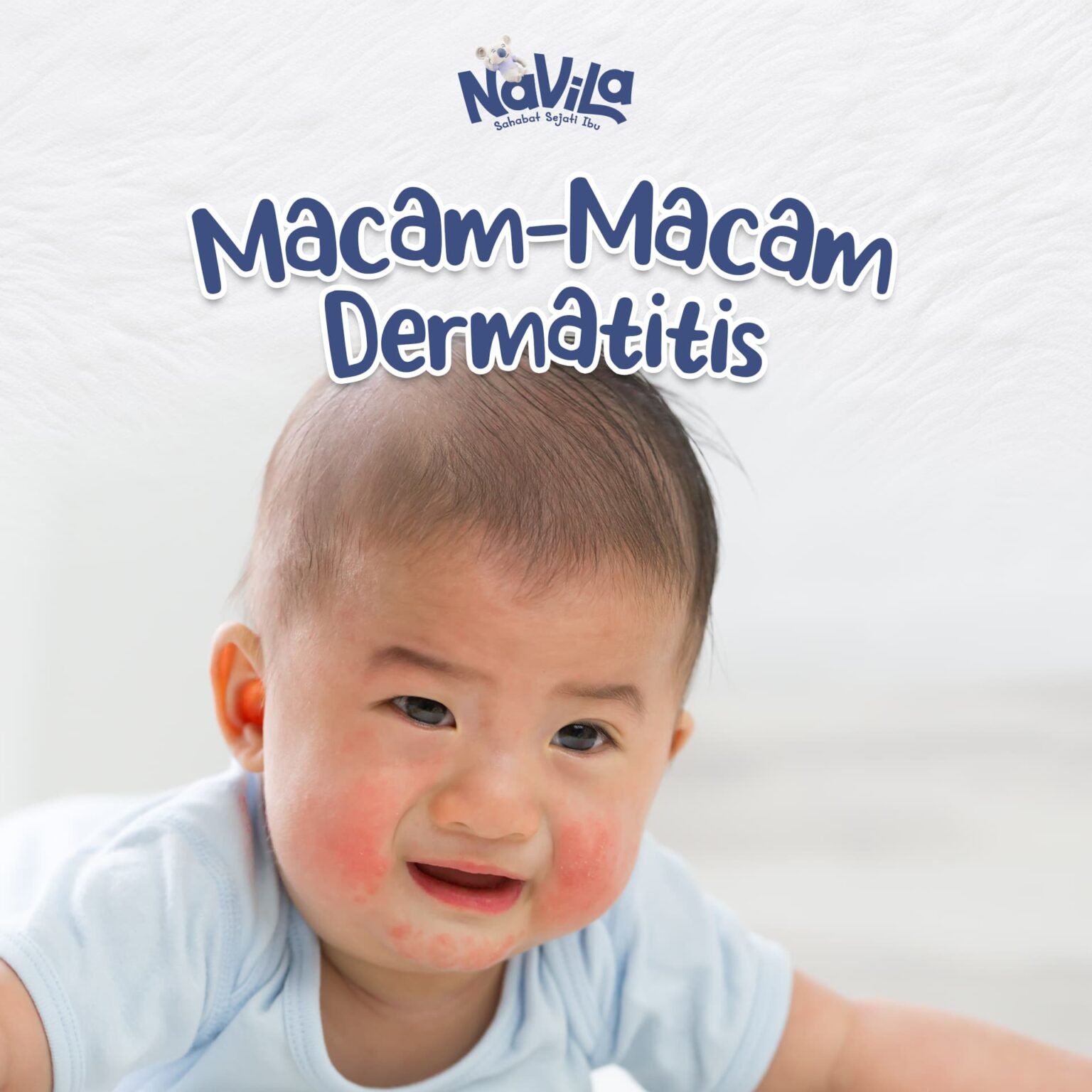 7 Macam Dermatitis yang Perlu Diketahui Beserta Gambarnya